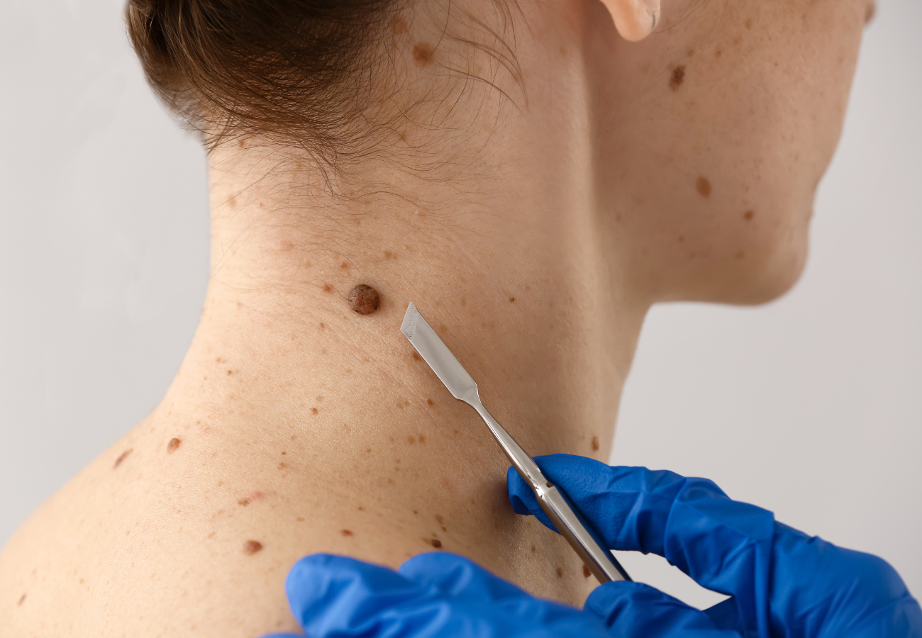 Dermatology Blogs | Dermatology Partners